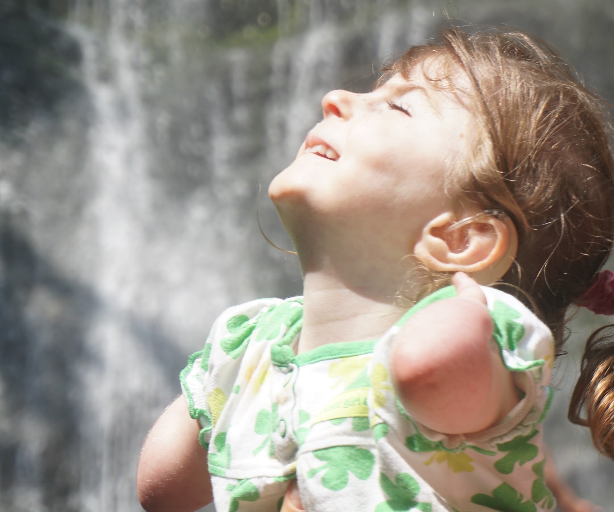 Turnerov syndróm | Genetické syndrómy