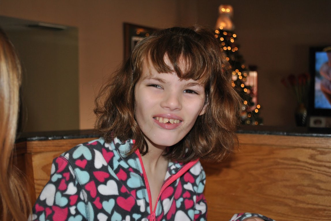 Cri du Chat - 5p syndróm - Syndróm mačacieho plaču | Genetické syndrómy